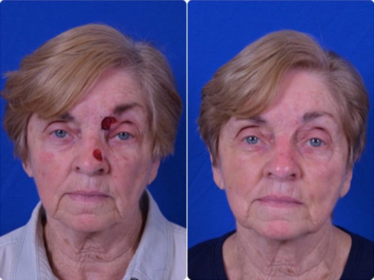 Reconstructive Plastic Surgery - Health Policy Monitor